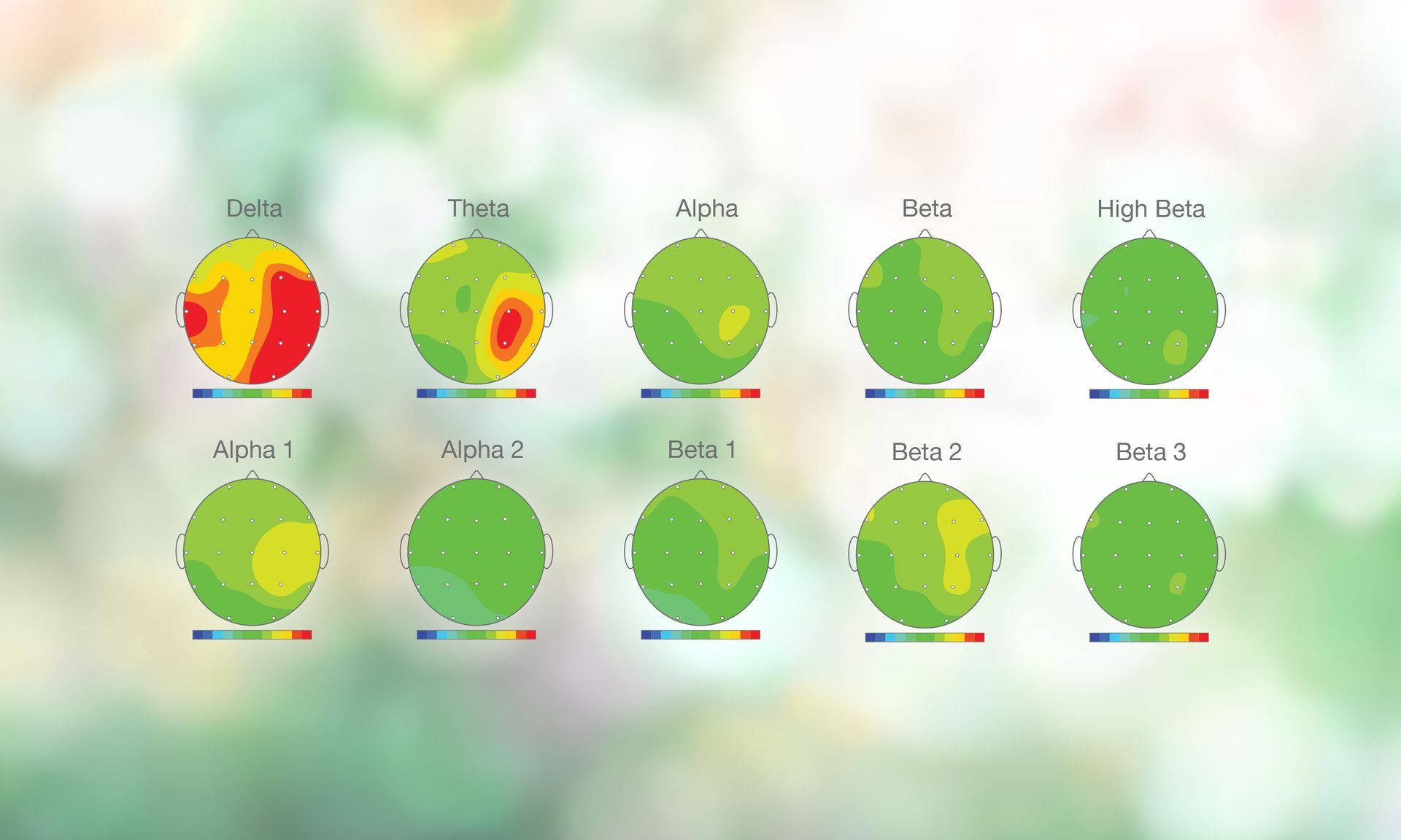 ANT Neuro Neurofeedback Solution