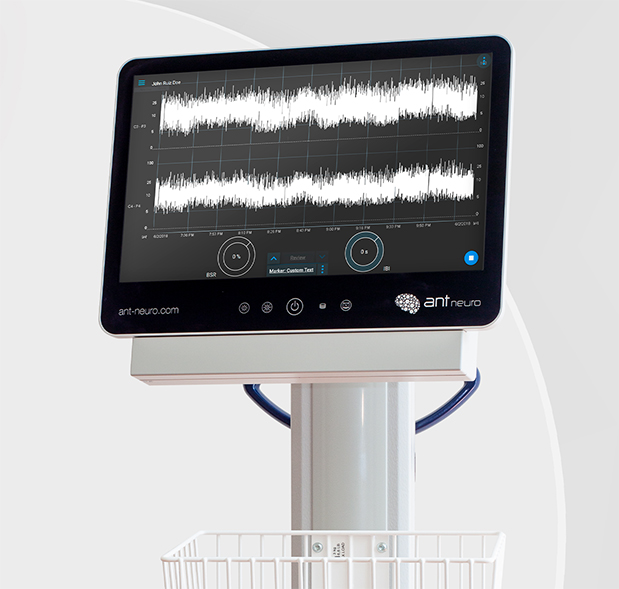 NICU and ICU Monitoring