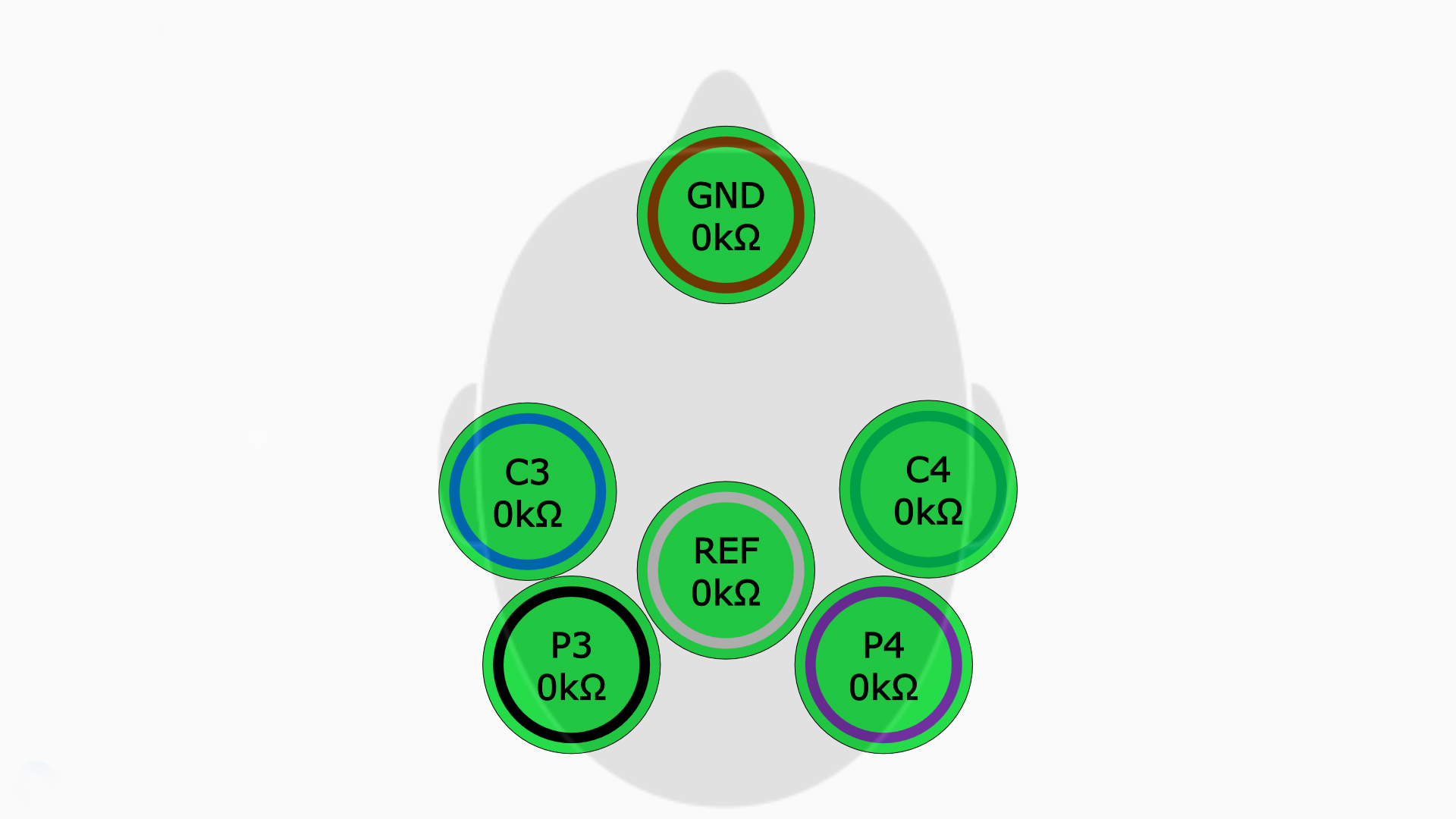 nëo aEEG Neuromonitoring for Neonatal Care