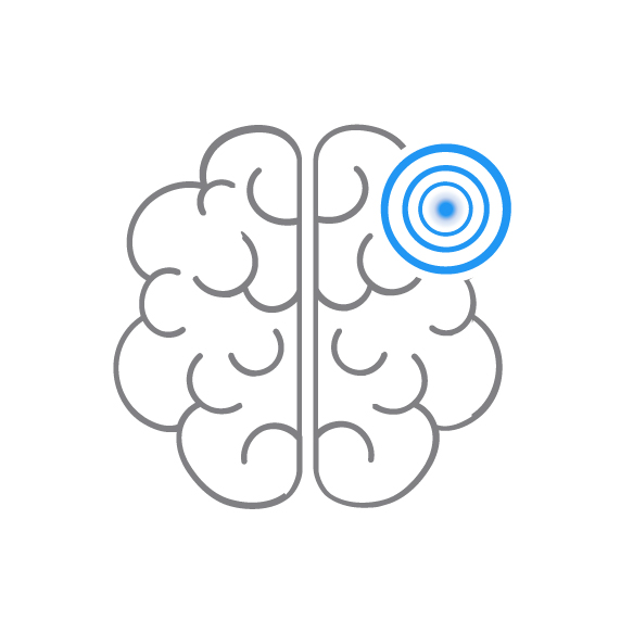 ANT Neuro | EEG Systems, EEG Caps & High‑Density EEG , Neuronavigation